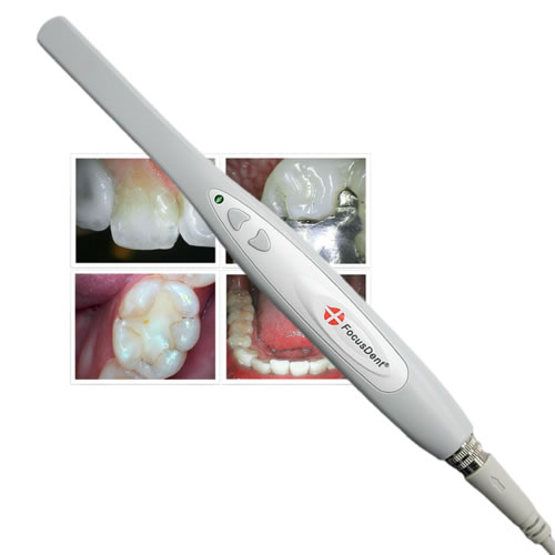 Intraoral Camera Benefits - Favoriteplus.com Blog